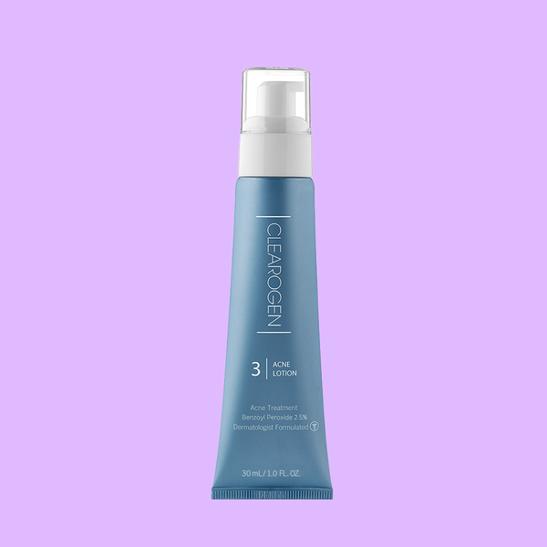 30-Day Ultimate Acne Clearing Lotion with 2.5 % Benzoyl Peroxide ...